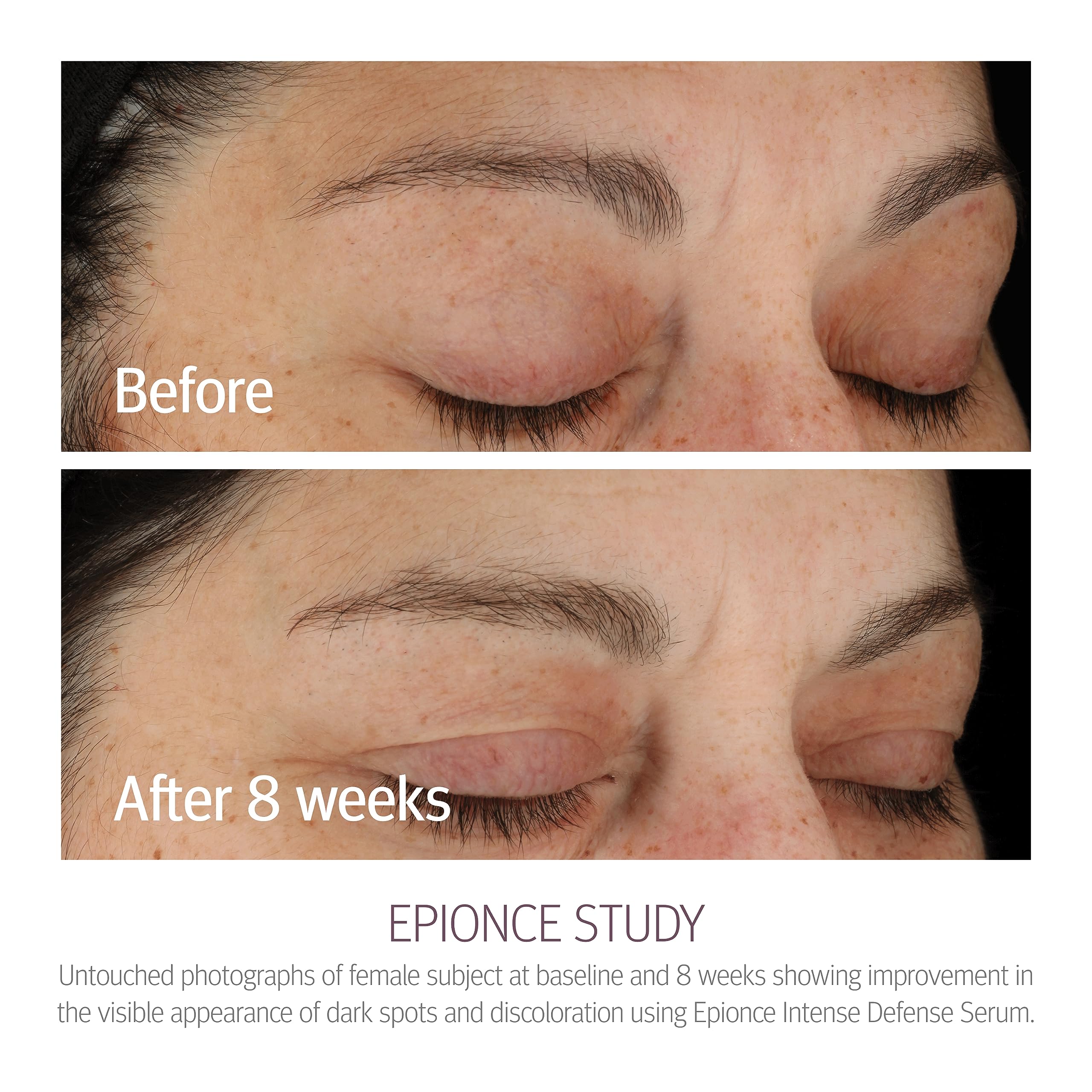 Sérum Epionce Intense Defense Anti Aging Com Vitamina Abcde - Carrefour